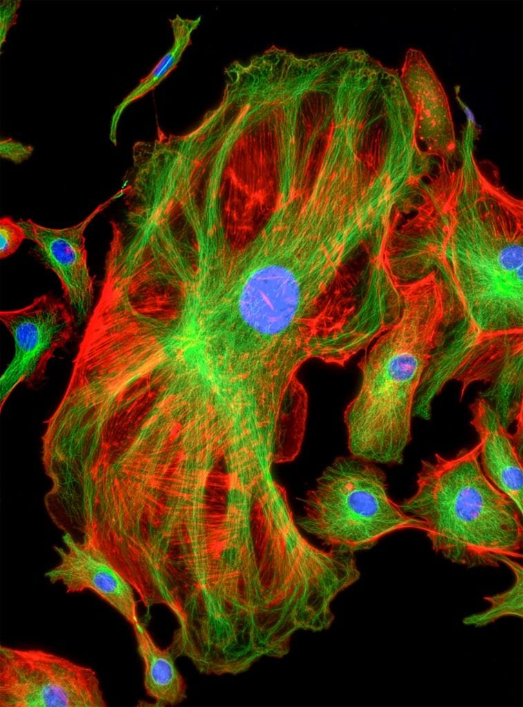 Quanta Biodesign - Stratech