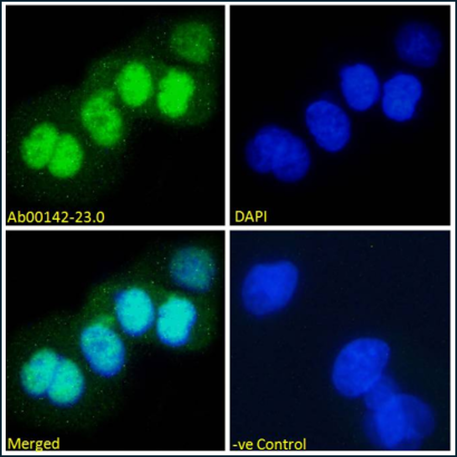 Absolute Antibody - Stratech