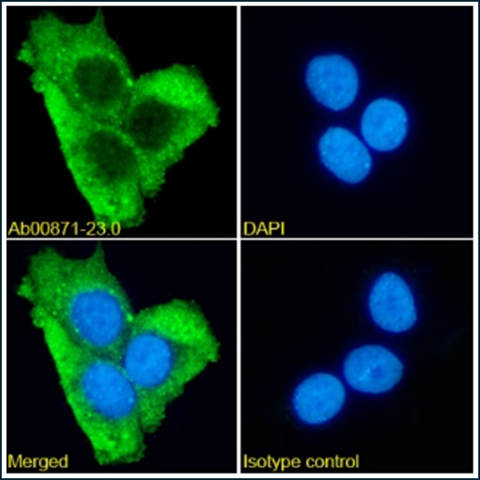 Absolute Antibody - Stratech